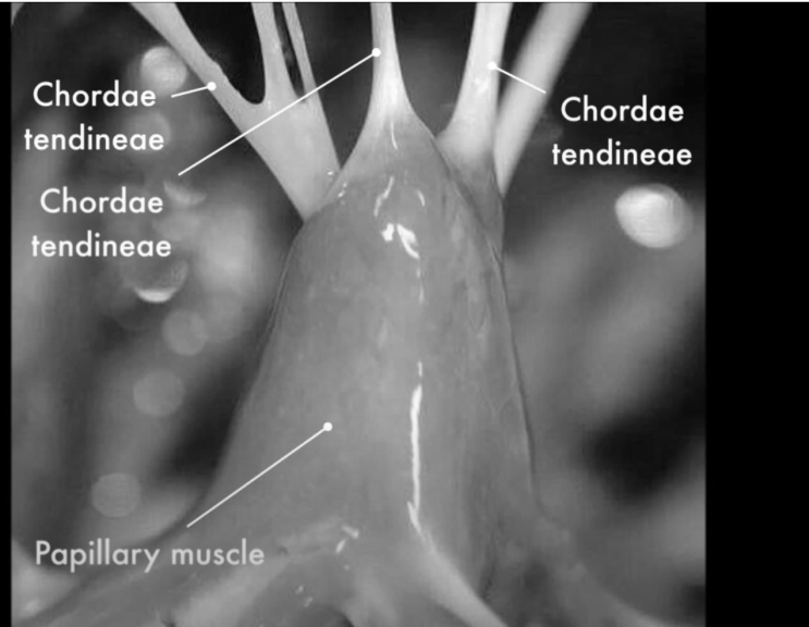 [인천동물심장내과] 강아지 이첨판폐쇄부전증에서 건삭파열 (Chordae tendineae ruptured : CTR)이란 ...