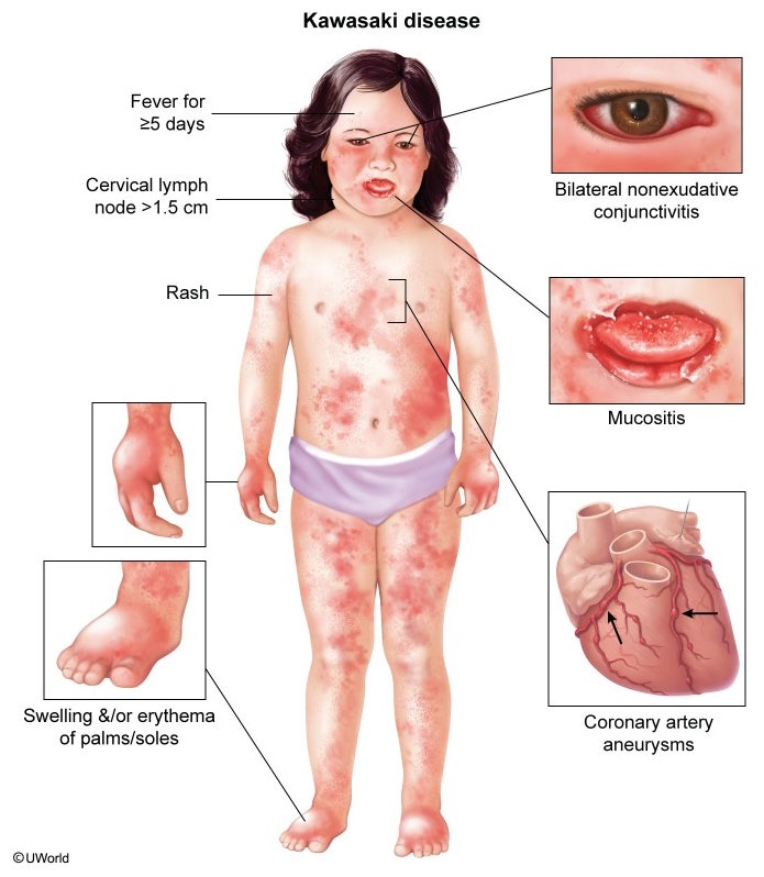 cardiovascular : 네이버 블로그