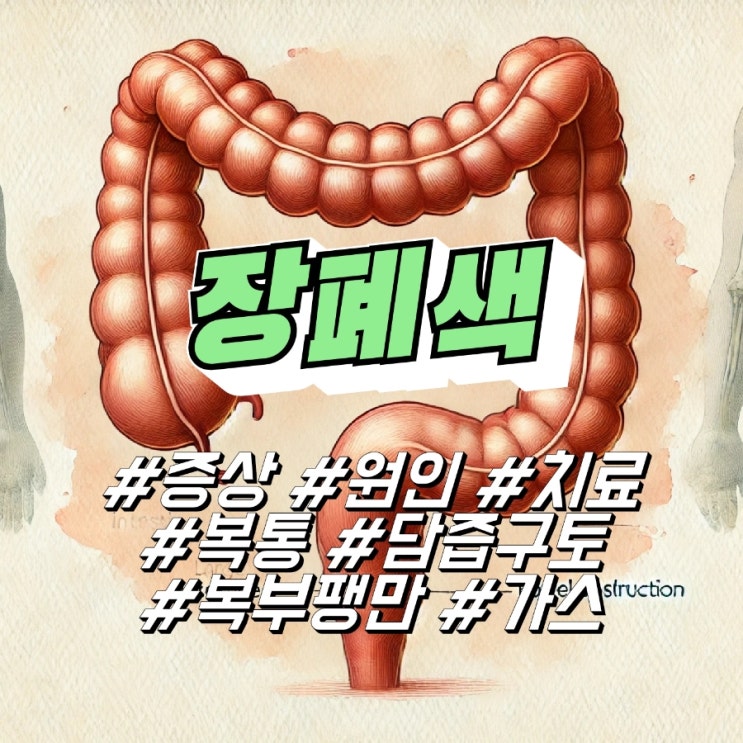 장폐색 증상 복통 원인 및 치료 응급실 담즙구토 복부팽만 가스 네이버 블로그