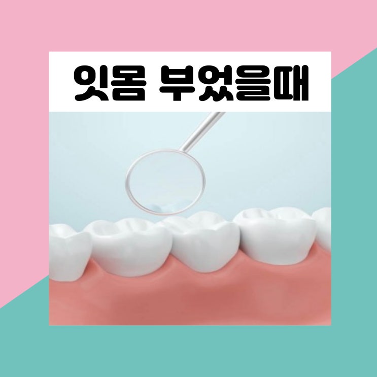 잇몸 부었을때 먹는 약 영양제 추천 잇몸 붓는 이유 무엇일까 네이버 블로그