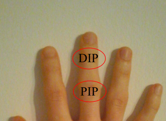 [영등한의원] 영등동한의원 익산한의원 손가락통증과 손가락 관절의 인대 DIP, PIP PULLEYS LIGAMENTS : 네이버 블로그