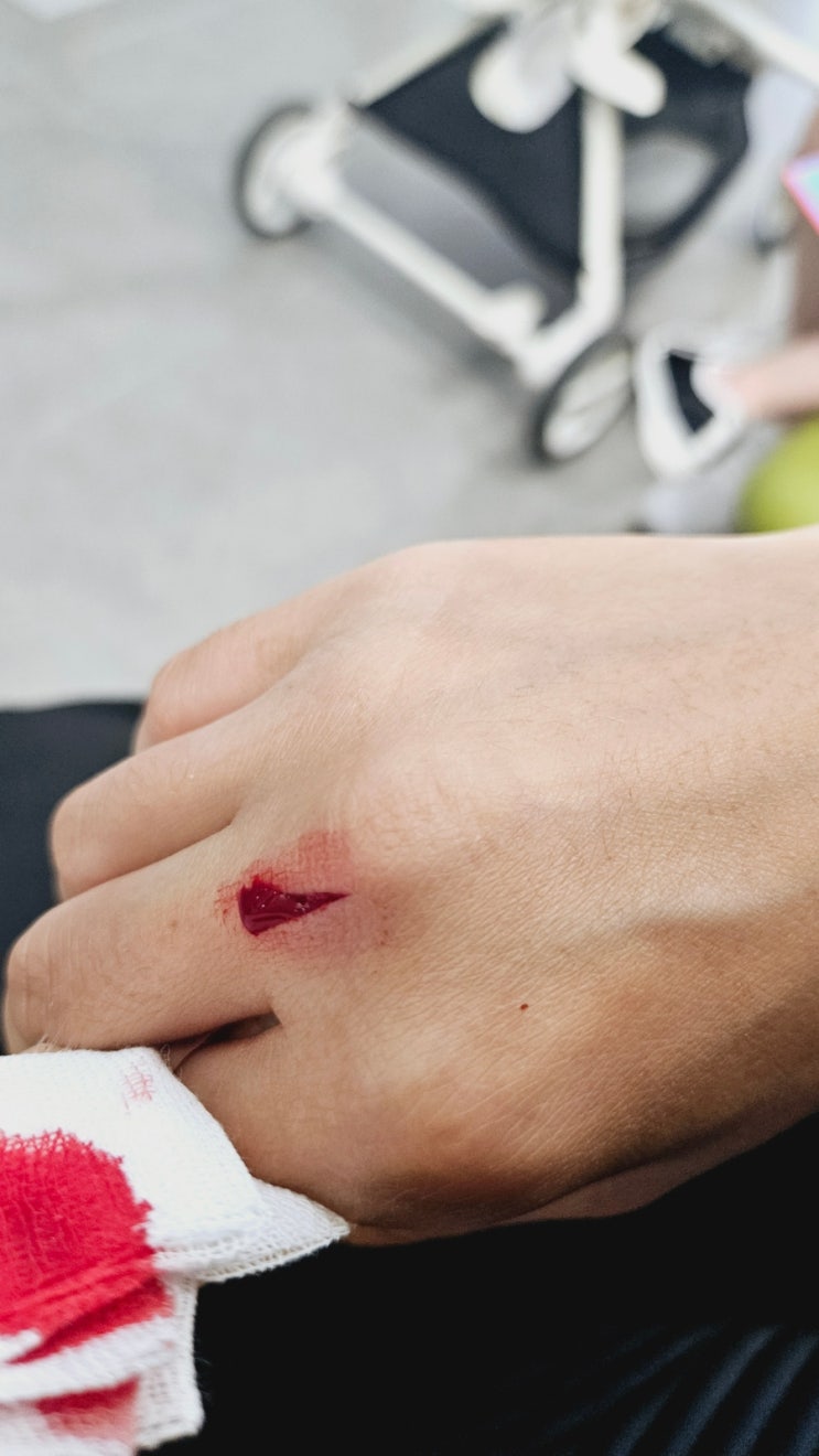 유리에 베었을때 응급처치 후 정형외과,응급실 가기 유리 버리는법 : 네이버 블로그