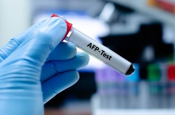 AFP 정상수치 AFP 수치 12 의미 원인 총정리 : 네이버 블로그