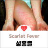 성홍열 개요와 A군 연쇄상구균 원인 Scarlet Fever 발열 두통 딸기혀 전신발진 증상과 검사 이목시실린 항생제 치료
