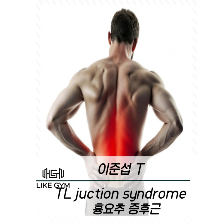 [암사헬스, 암사PT] TL junction syndrome 흉요추 증후근 : 네이버 블로그