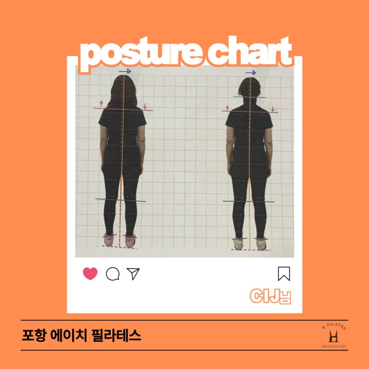 포항 체형 교정 필라테스 l posture chart🧡CIJ님 : 네이버 블로그