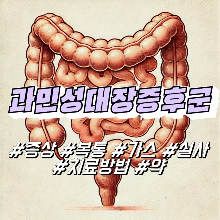 과민성대장증후군 증상 복통 복부팽만 가스 설사 과민성대장증후군약 치료 네이버 블로그