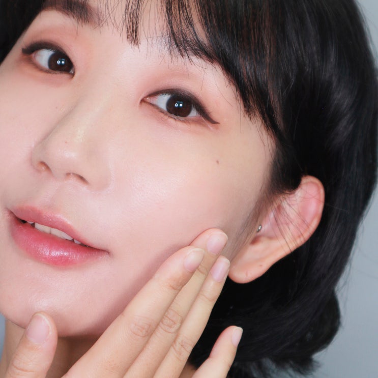 여드름흉터 없애는법 피부트러블 염증성여드름에 좋은 낫츠 센텔라스카 연고 네이버 블로그