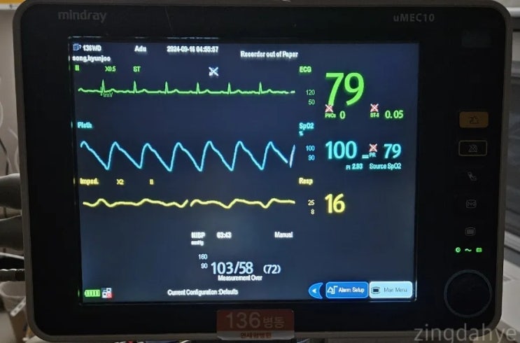 병원 환자 모니터 보는 방법 (HR, SpO2, RR, DBP, SBP, Afib) : 네이버 블로그