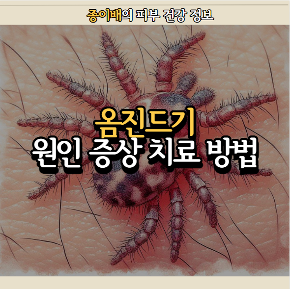 옴 진드기 개선증 원인 증상 전염 치료 방법 완치 네이버 블로그