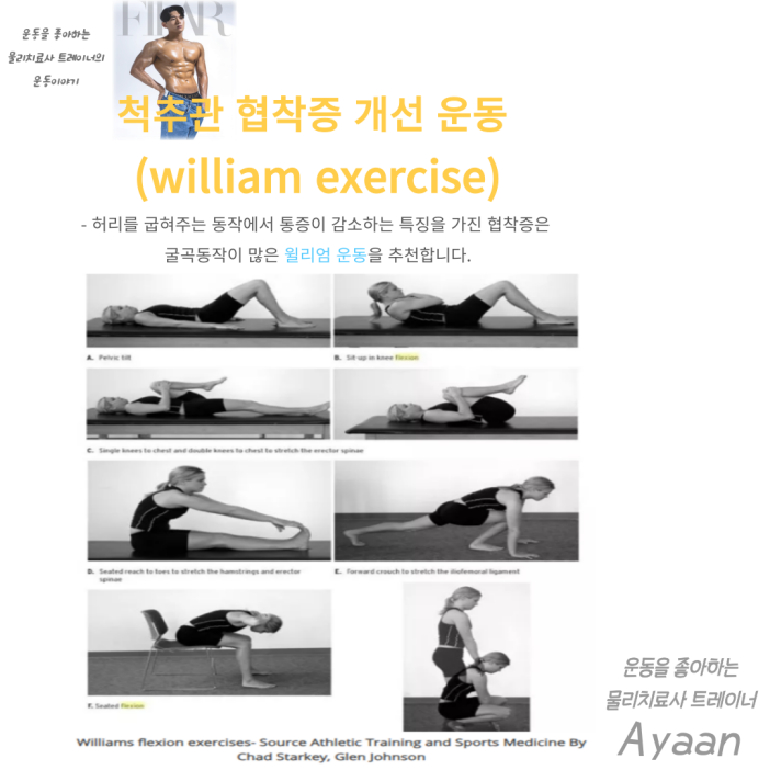 [침산동PT, 대구 물리치료사 트레이너] 척추관협착증의 개선 운동? / 윌리엄 운동(William exercise) / 허리 ...