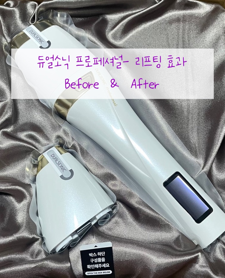 뷰티디바이스 듀얼소닉 프로페셔널 3회 사용 후기 부작용과 달라진 피부 탄력과 리프팅 효과 네이버 블로그