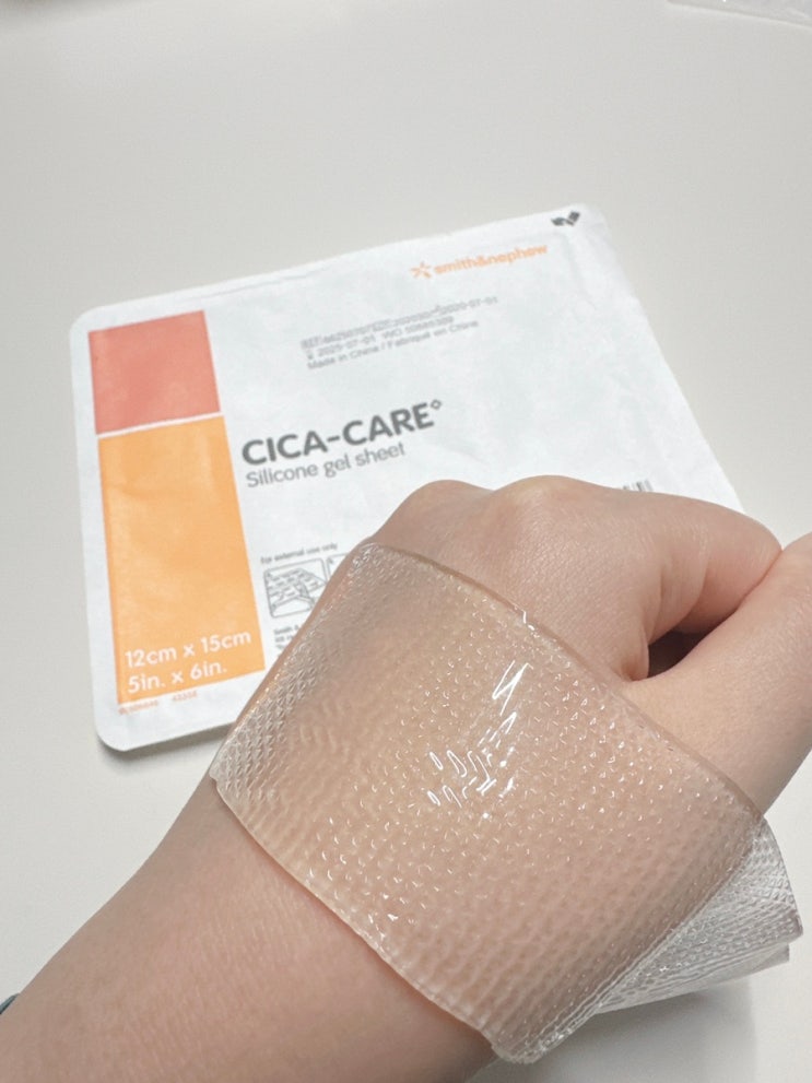 제왕절개 수술 흉터관리 테이프 시카케어밴드 실리콘 겔시트 부착방법 : 네이버 블로그