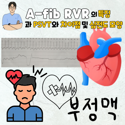 A-fib RVR EKG 모양 및 특징 그리고 PSVT와 A-fib RVR 차이점 : 네이버 블로그