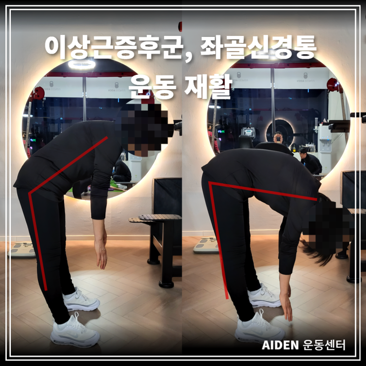 광주 남구 봉선동 이상근증후군 좌골신경통 운동재활 허리통증 다리저림 재활pt 네이버 블로그