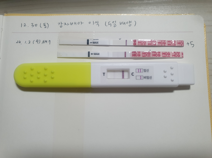 시험관 2차 5일배양 6일차7일차8일차 임테기 진하기 이식후 증상임신 극초기 5일배아 감자배아 네이버 블로그