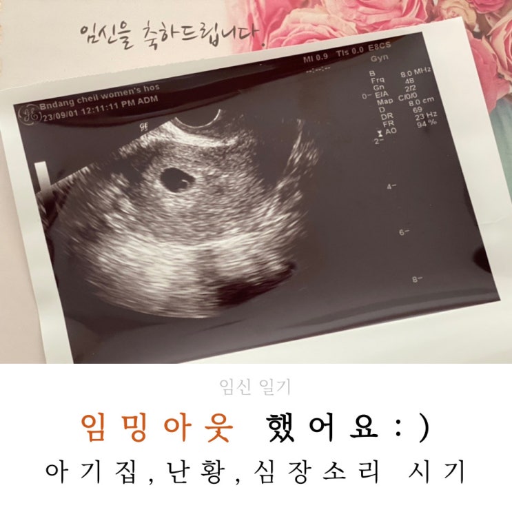 난황 아기집 심장소리 시기 임밍아웃 임신확인서는 언제 발급받나요 네이버 블로그