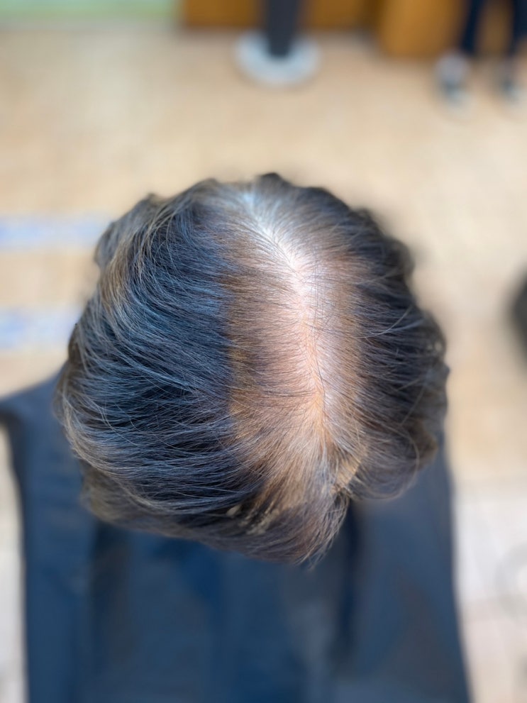 부산탈모전문미용실 중년여성탈모펌 금융치료후 대변신 일타탈모펌원장님 연산동래금정반송해운대가야명지김해녹산경주진주창원양산울산가