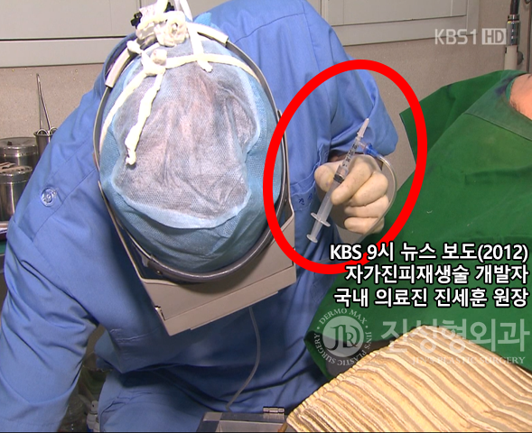 자가진피재생술 수기시술? 손주사? 시술 개발자가 딱 알려드릴게요. : 네이버 블로그