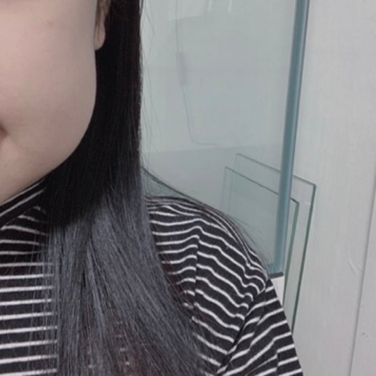 완전 매복사랑니 윗니 발치 4~7일차 회복 과정 후기와 염증없는 회복 방법 식사붓기실밥제거 네이버 블로그