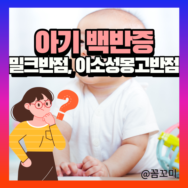 아기 백반증 원인 치료 밀크커피반점 이소성몽고반점 네이버 블로그