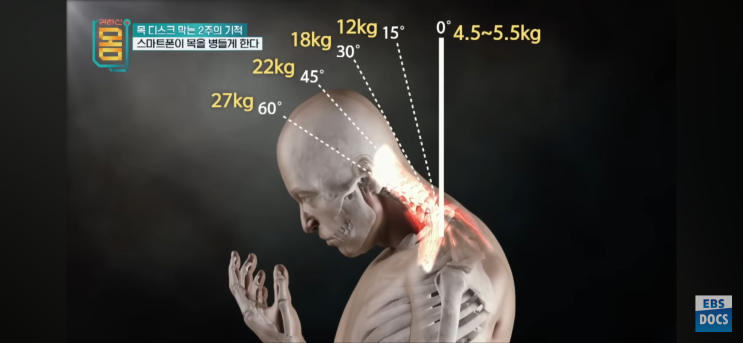 귀하신몸 목디스크 운동 목디스크 예방 운동법 및 치료에 좋은 운동 방법 네이버 블로그
