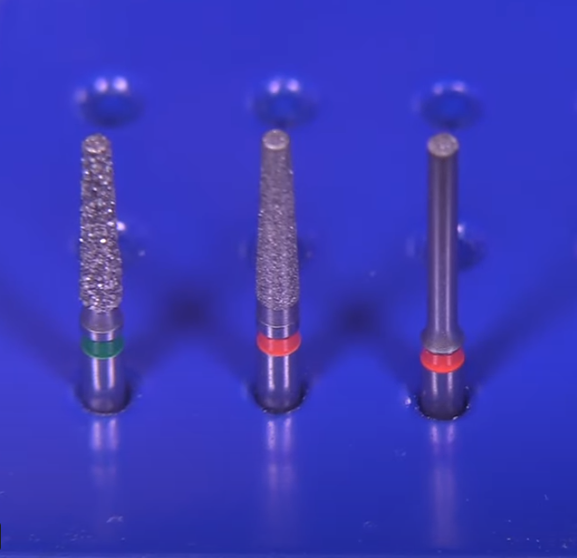 PFM Preparation on The Maxillary First Molar for #3 Kilgore | Stevenson ...