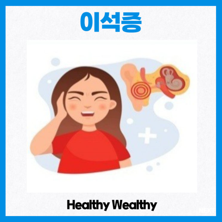 이석증 증상 원인은 자가진단 치료 운동 수면자세 커피 진단법 어지러움 네이버 블로그
