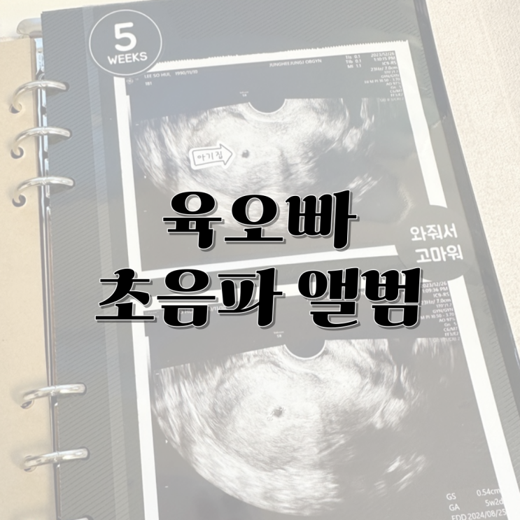 초음파 앨범 임신 초기 선물 추천 육오빠 초음파앨범 네이버 블로그
