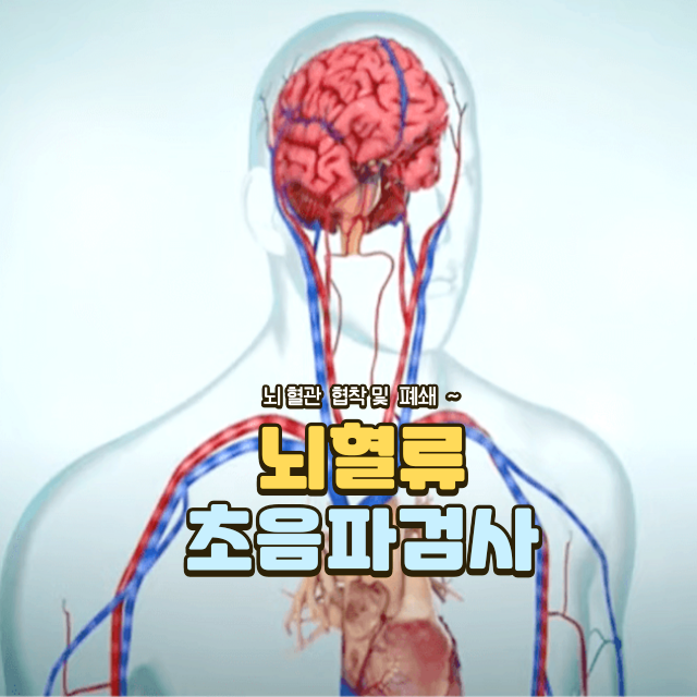 뇌혈류 초음파 검사 방법과 장단점 검사비용 네이버 블로그