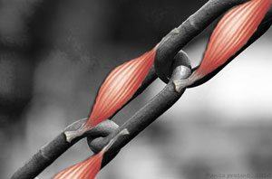 Open Versus Closed Kinetic Chain Rehabiiitati~nof the Lower Extremity:A ...