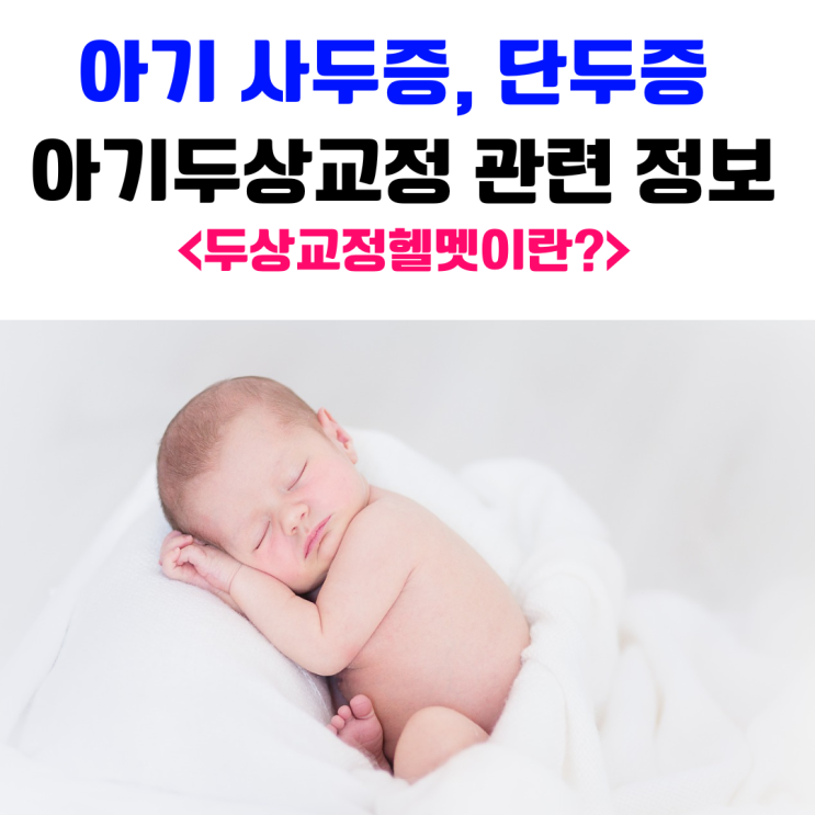 신생아 아기머리 사두증 단두증 및 아기두상교정 두상교정헬멧 정보 네이버 블로그
