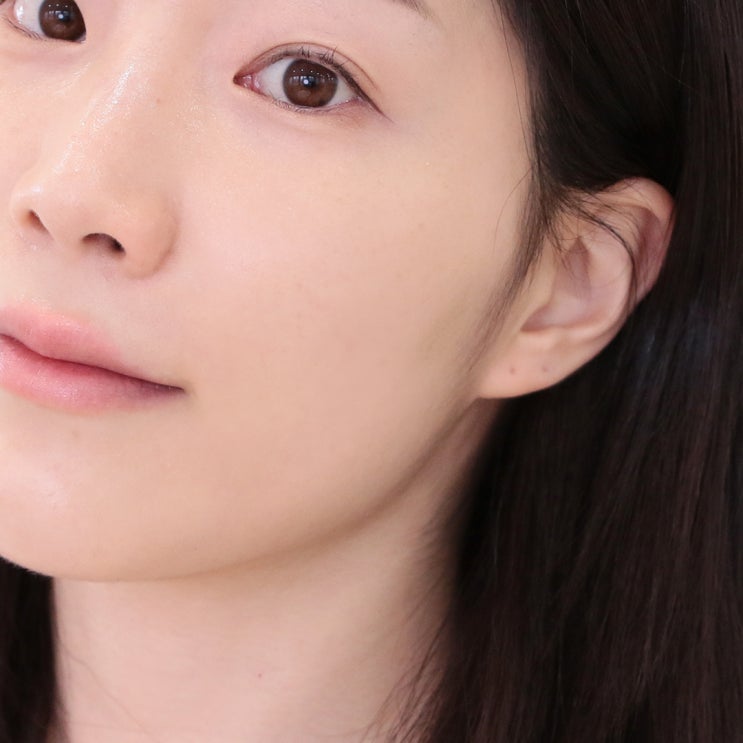 써마지 FLX 600샷 후기, 비용/가격, 수면마취 통증 정보공유 : 네이버 블로그