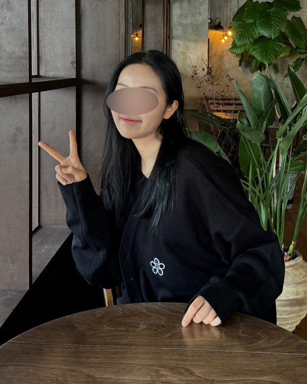 강남 신논현 피부과 요즘 핫한 티타늄 레이저 트리코어리프팅 하고 왔어요 찐후기 통증 효과 부작용 전후사진