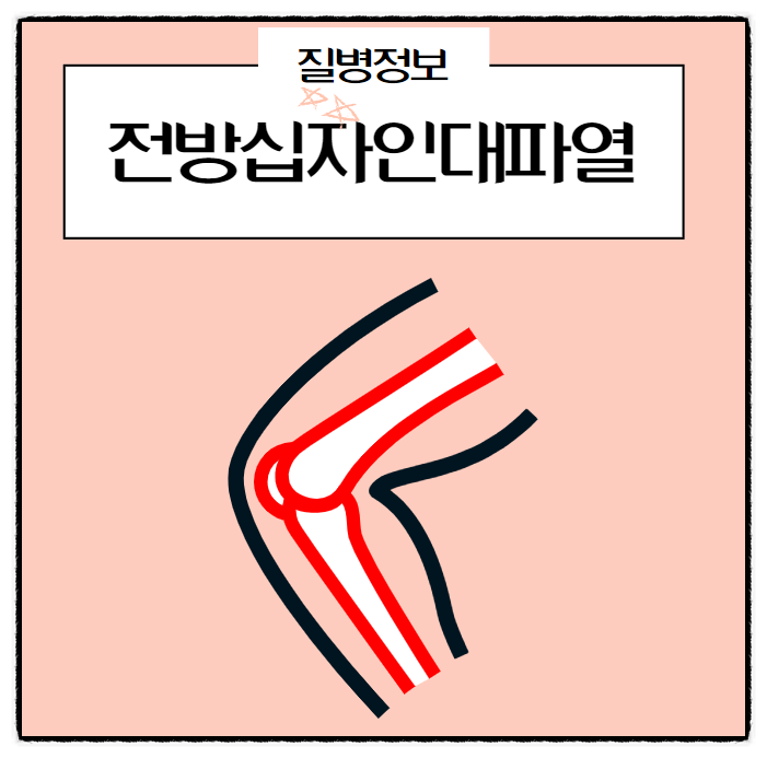 무릎 전방 십자 인대 파열 증상 수술 후유증 남는걸까 네이버 블로그
