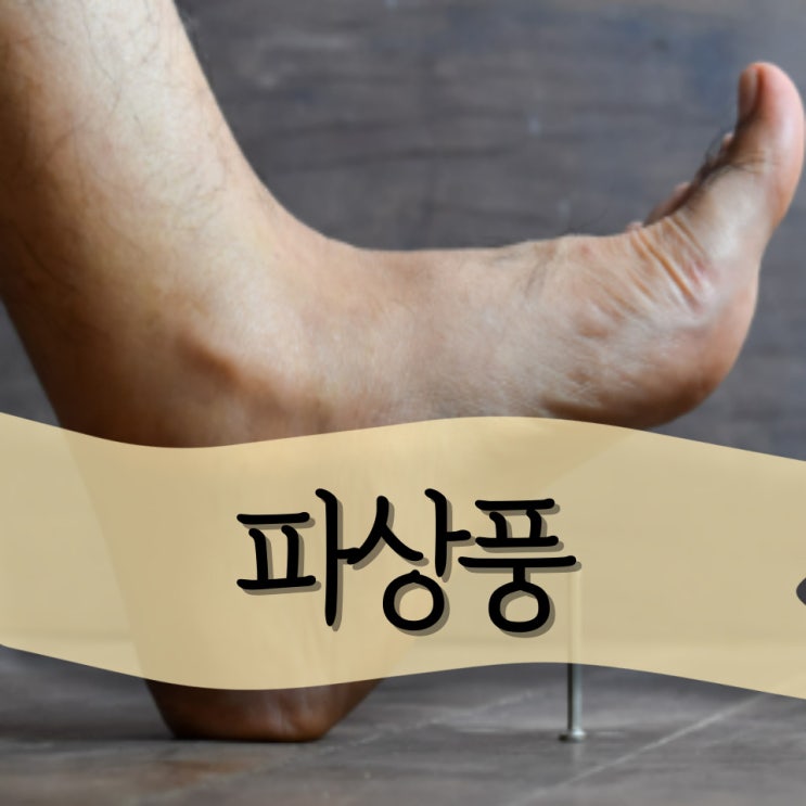 파상풍tetanus 초기 증상 및 파상풍 예방접종 주사못에 찔렸을때 네이버 블로그
