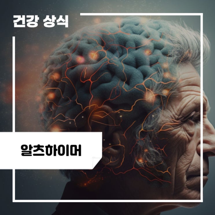 알츠하이머 초기 증상 및 원인 검사 예방 방법 치매 차이 네이버 블로그