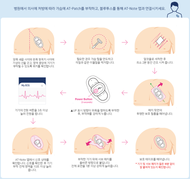 CM 진단검사 [TTE/TEE, 24hr Holter, event recoder, loop lecorder, TMT, IMT ...