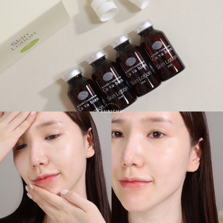여드름피부 스킨로션 추천 여자 지성피부 유수분밸런스 관리 네이버 블로그