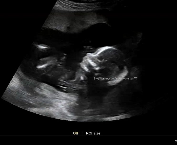 임신 극초기 증상 및 임신 잘되는법 아기집 보이는 시기 확인열하혈허리아랫배 통증두통 네이버 블로그