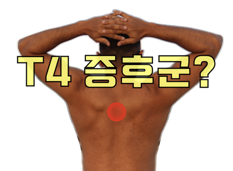 T4 syndrome(T4 증후군, 상부흉추증후군)의 원인 및 치료 : 네이버 블로그
