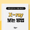 X Ray 보는 방법 신규간호사라면 꼭 알아야 하는 엑스레이 Xray 엑스레이 방사선 네이버 블로그