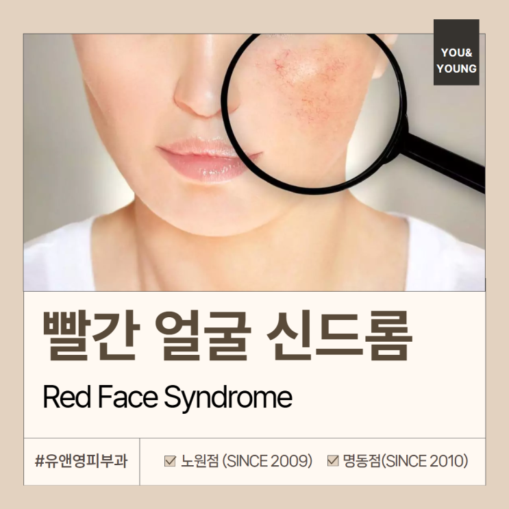 빨간 얼굴 신드롬 (Red Skin Syndrome) : 네이버 블로그