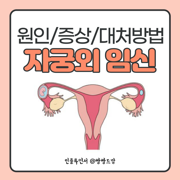 자궁외임신 증상 원인 생리 대처방법 네이버 블로그