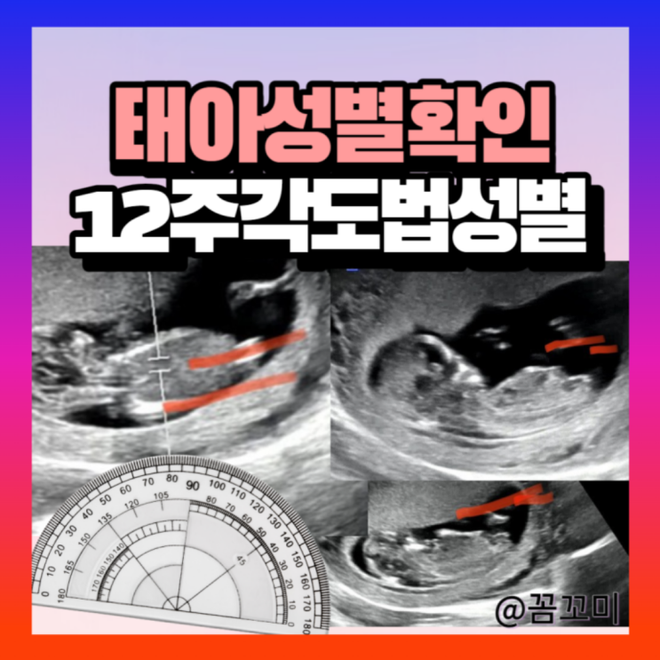 태아성별확인시기 아기 성별각도법 난황위치 베이킹소다 성별확인 네이버 블로그