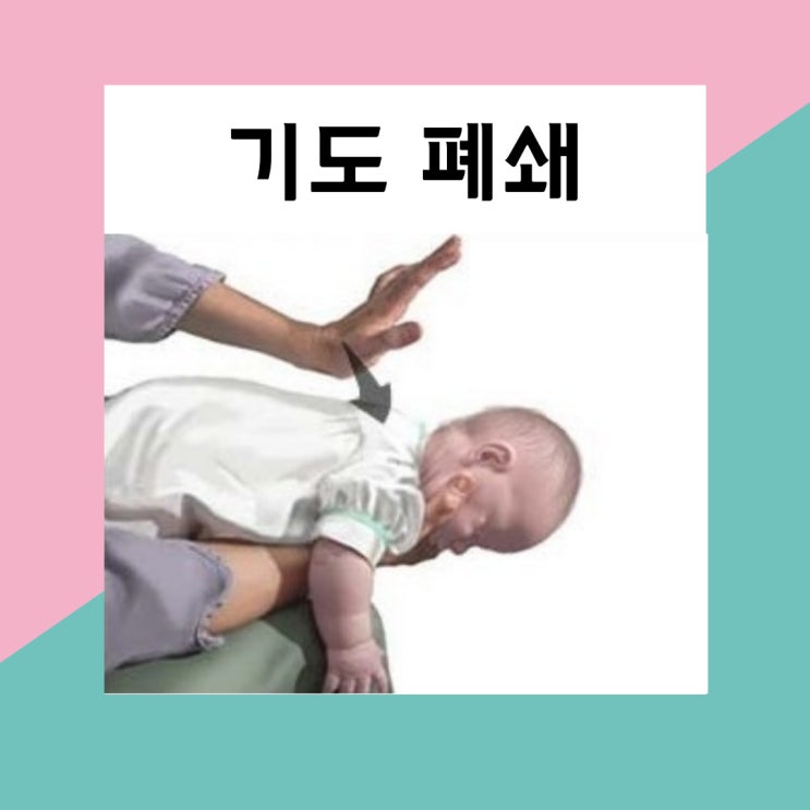 셀프 하임리히법 기도 폐쇄 응급처치 소아 영아 성인 네이버 블로그