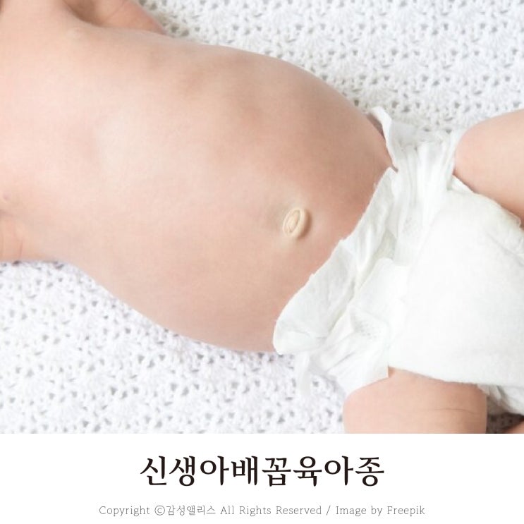 신생아배꼽피 아기 신생아 배꼽탈장 신생아배꼽육아종 치료는 네이버 블로그
