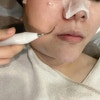 일산 주엽 피부관리 스킨소울 하이푸 물방울 관리 후기 네이버 블로그