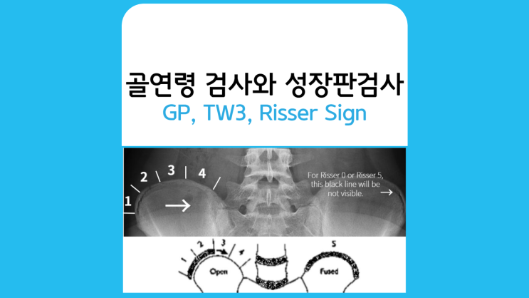 성장판 검사 병원-GP(Greulich Pyle), TW3(Tanner, whitehouse 3), 리서사인(Risser ...