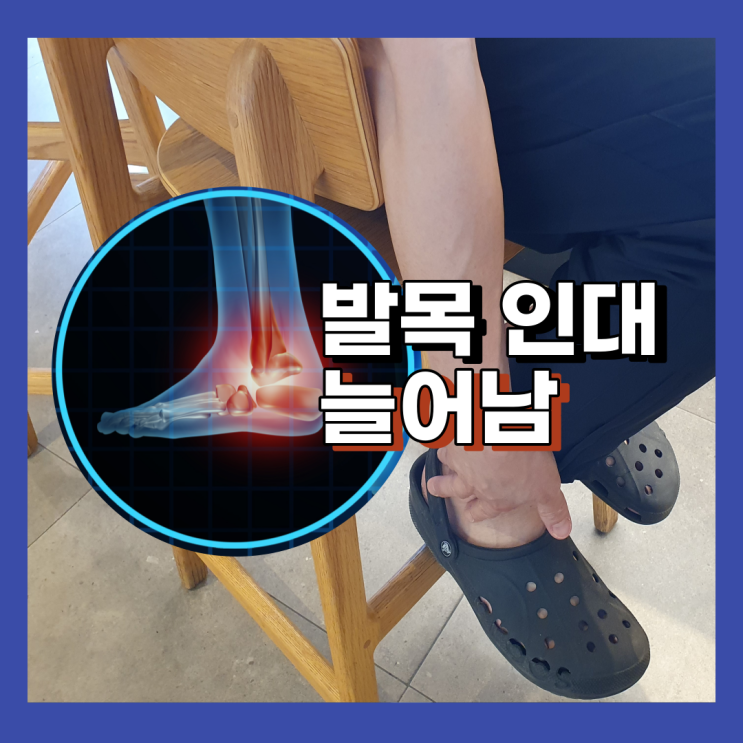 발목 인대 늘어났을때 치료 방법 및 증상 회복기간 운동에 대해 알아보면 네이버 블로그